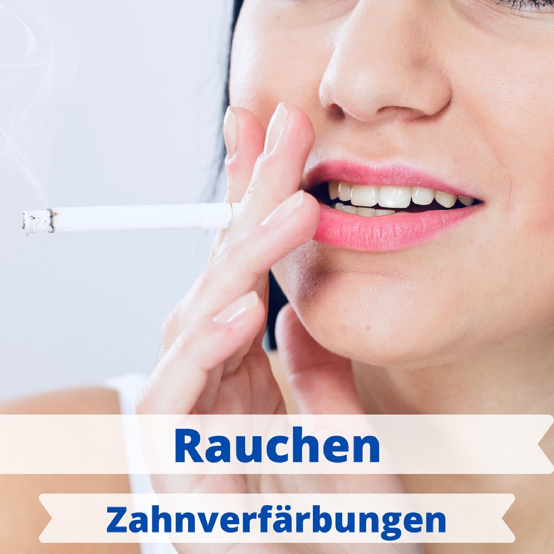 ️ Rauchen - Zahnverfärbungen - SOLO Zahnarztpraxis Leipzig