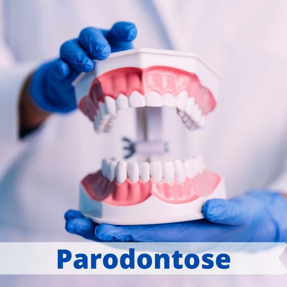 ️ Was ist Parodontose? ???? - SOLO Zahnarztpraxis Leipzig