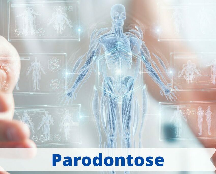 ️ Parodontose: Folgen für die Gesamtgesundheit - SOLO Zahnarztpraxis ...